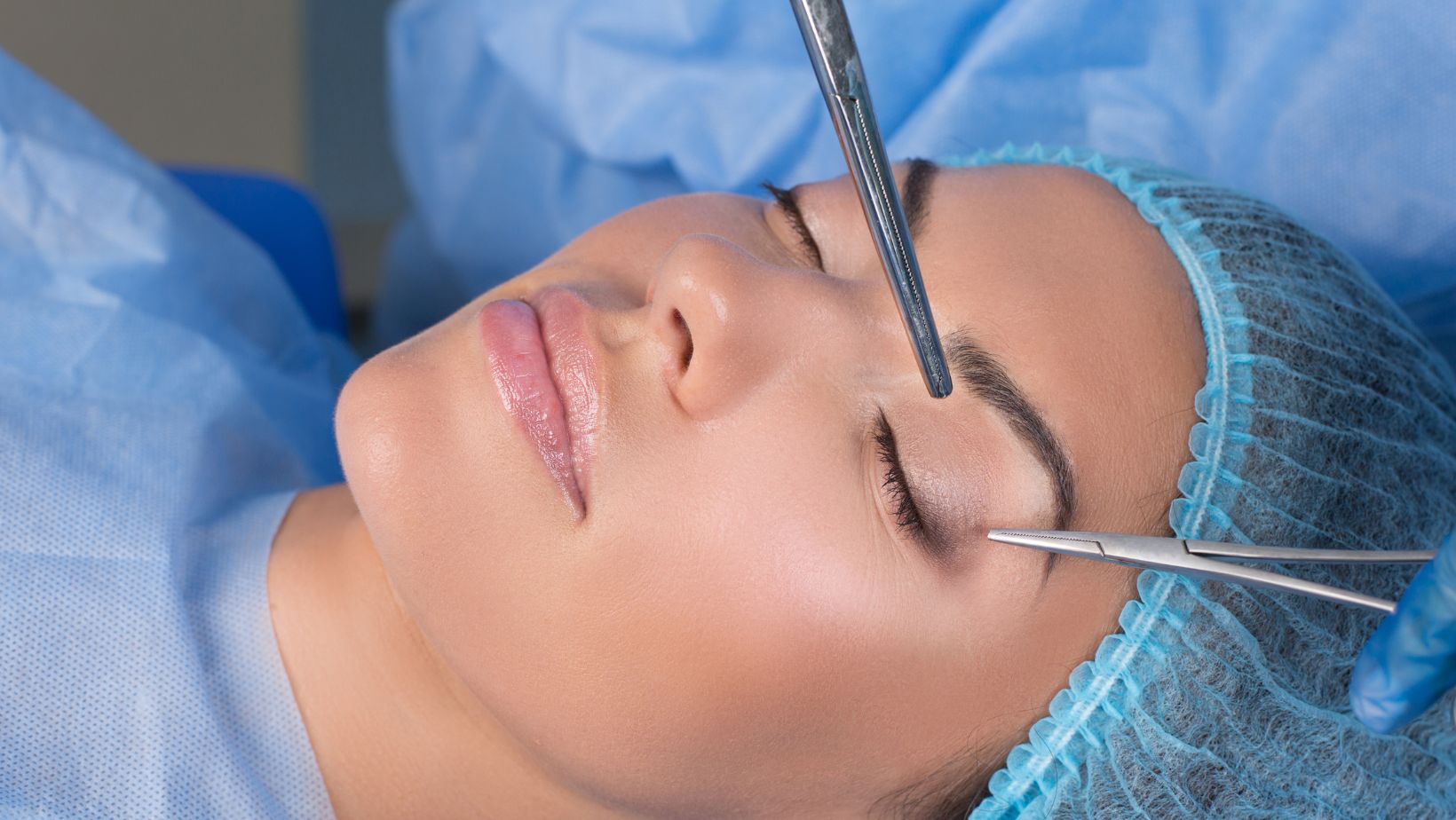 Ready For A Change? Explore The Wonders Of Upper Eyelid Surgery ...